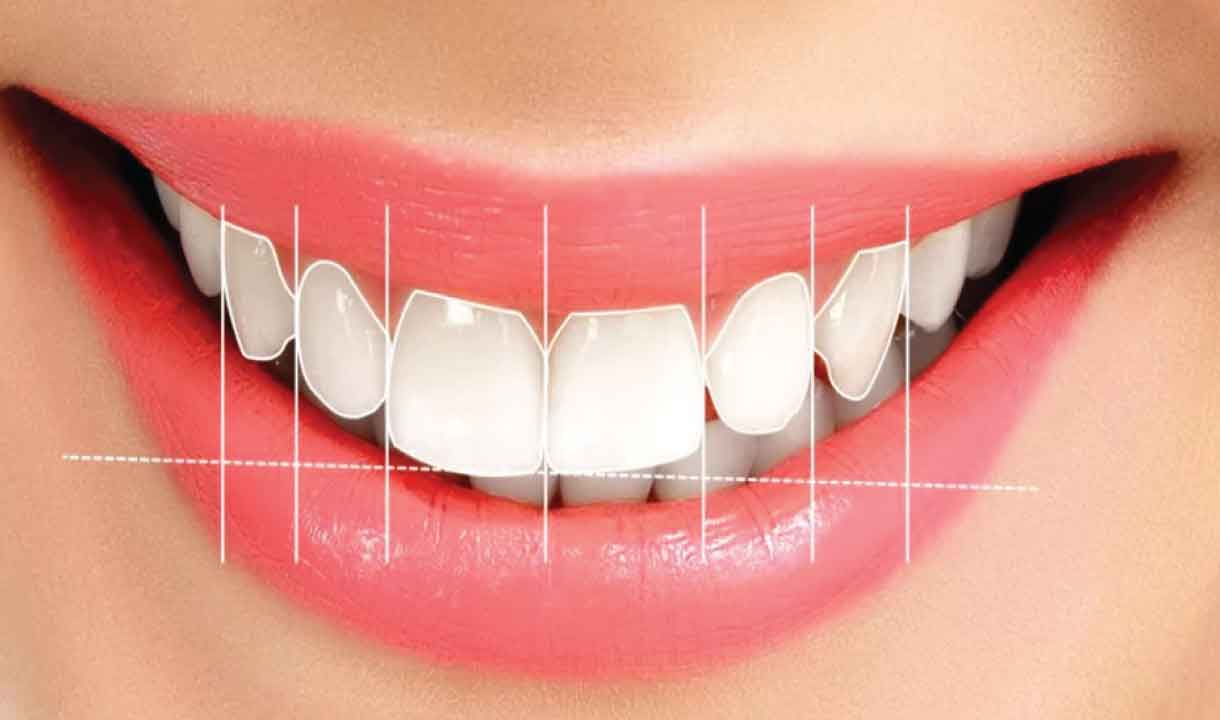 Smile Design | Lifemed Dental